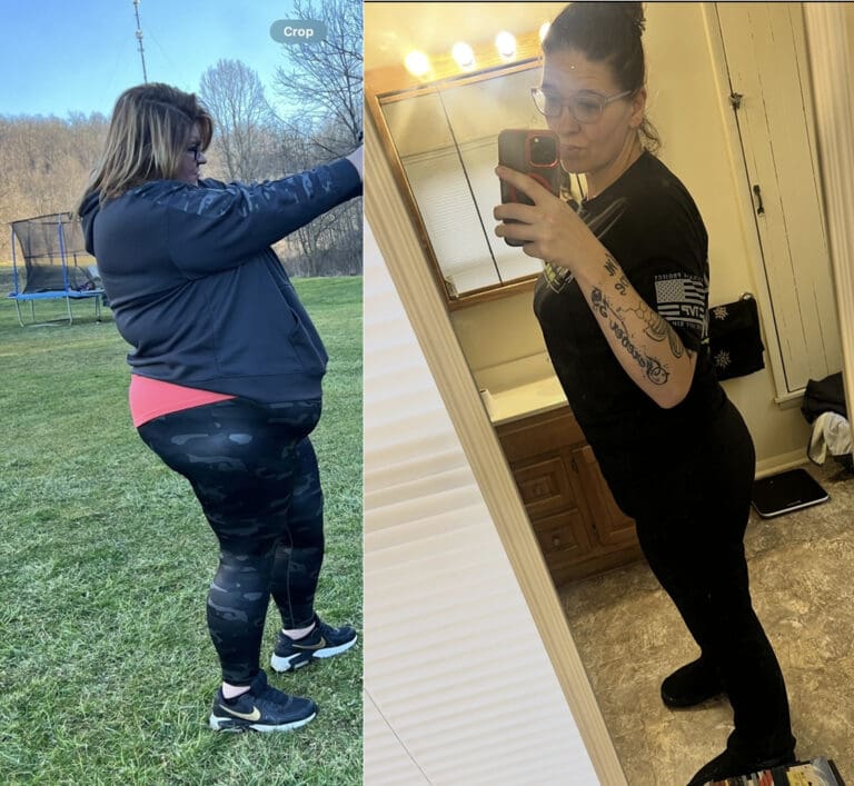 SIPS/SADI/LDS Versus Sleeve--What's the Difference | JourneyLite ...