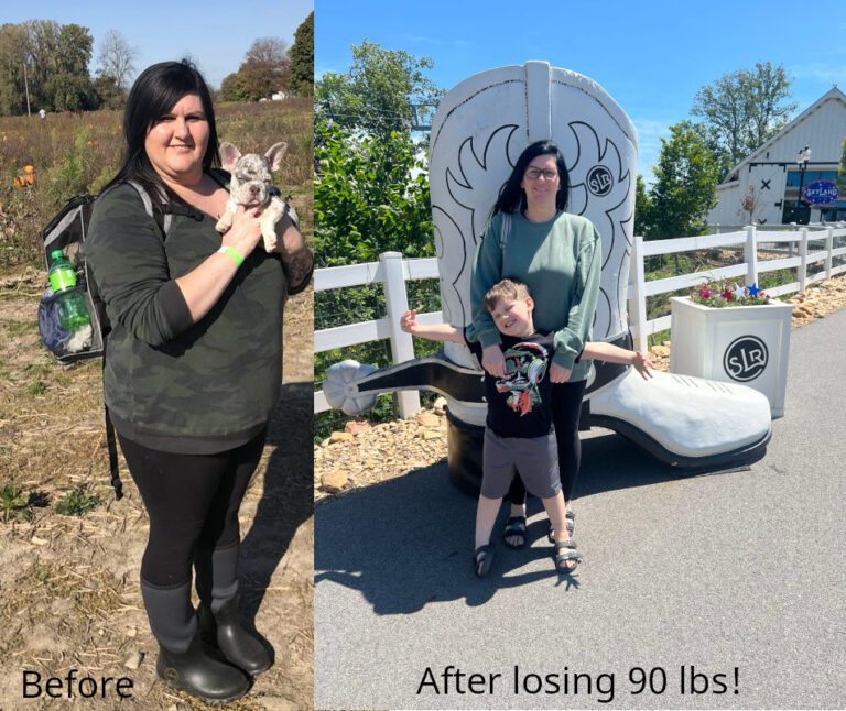 SIPS/SADI/LDS Versus Sleeve--What's the Difference | JourneyLite ...